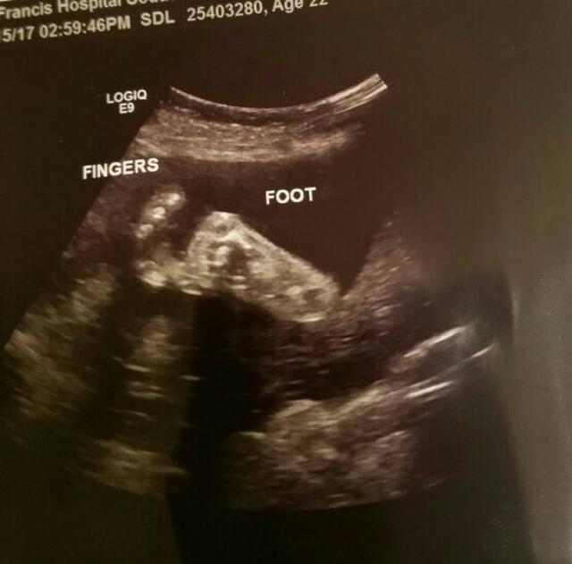 My baby boy grabbing his feet with his hand, he was playing around the ...