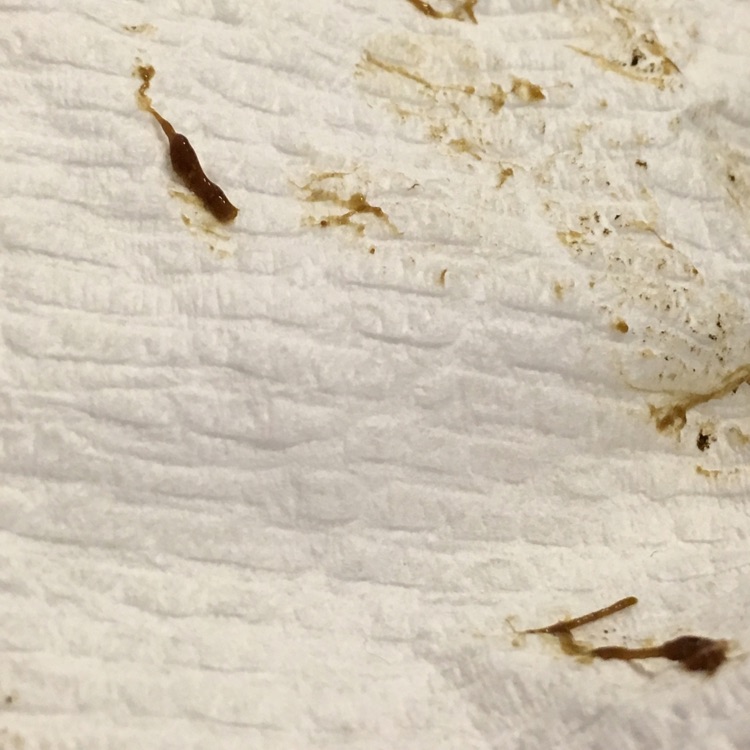 DISTURBING PICTURE i have no idea what's in my stool, I thought it ...