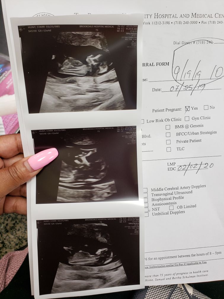 Nipt results - Glow Community