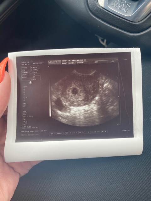 5 week ultrasound & 6 week 4 day ultrasound - Glow Community