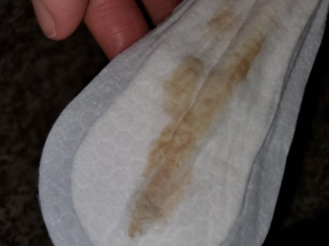 11 dpo discharge or spotting or implantation bleeding? - Glow Community