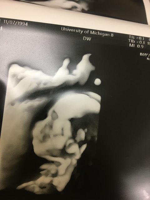 20-week-anatomy-scan-glow-community