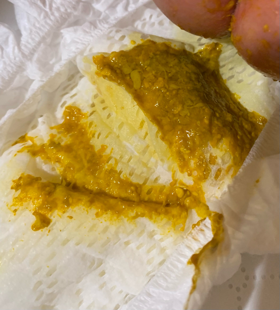 Is this diarrhea? (poo photo included) - Glow Community