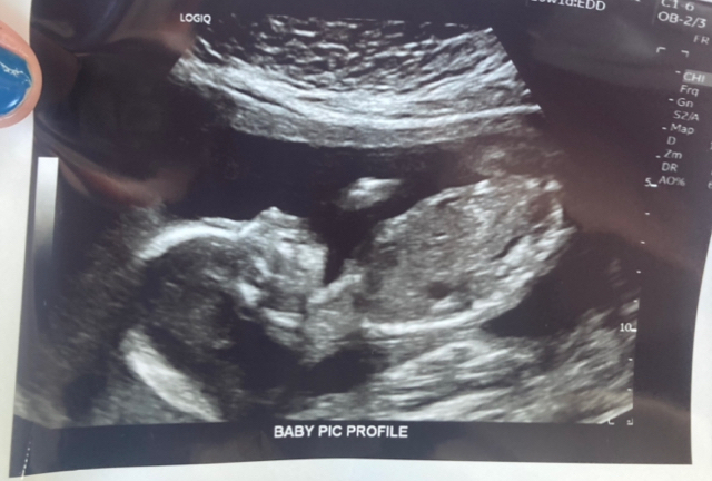 Anatomy scan! - Glow Community