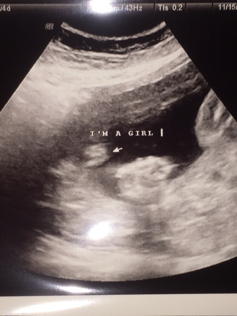 24 Weeks Ultrasound Gender