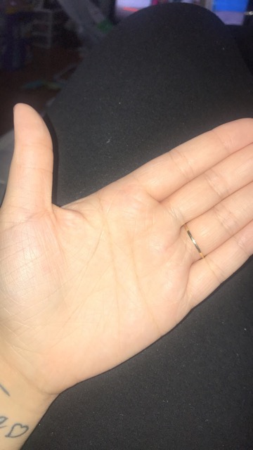 Why do i have so many lines on my hand?? Look!! - Glow Community