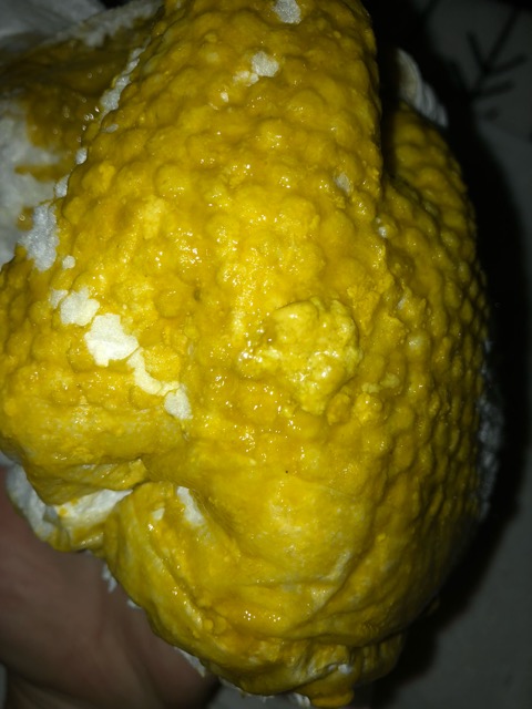 Strange poop - diaper pic TMI warning! - Glow Community