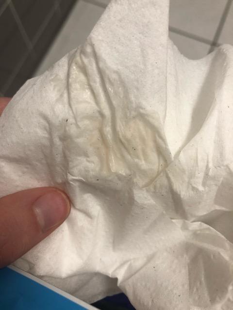Keep Having Pink Discharge When I Wipe Almost 9 Weeks Pregnant Am I Having A Miscarriage keep-having-pink-discharge-when-i-wipe-almost-9-weeks-pregnant-am-i-having-a-miscarriage