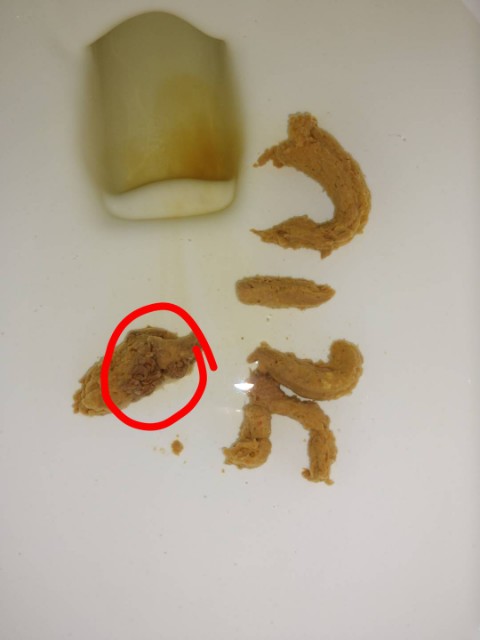 💩 What does this look like? - Glow Community