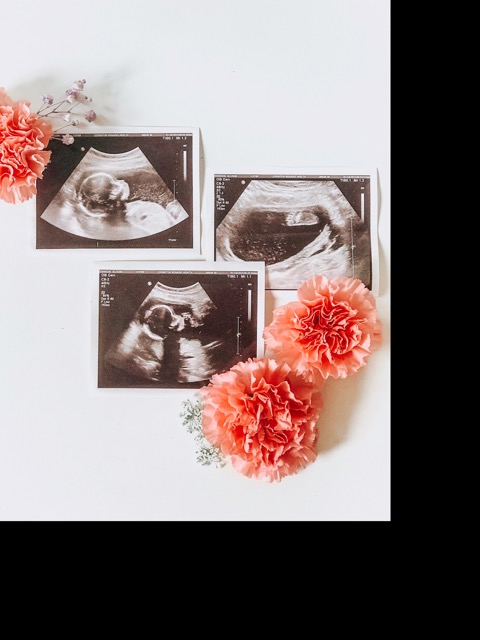 20-week-anatomy-scan-glow-community