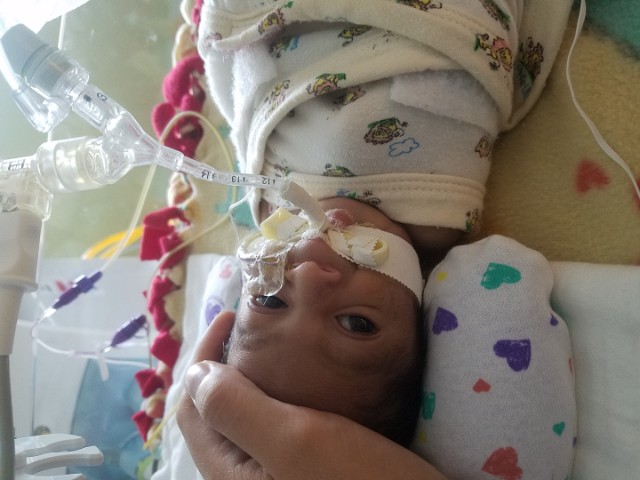 Baby born with one lung 😔 - Glow Community