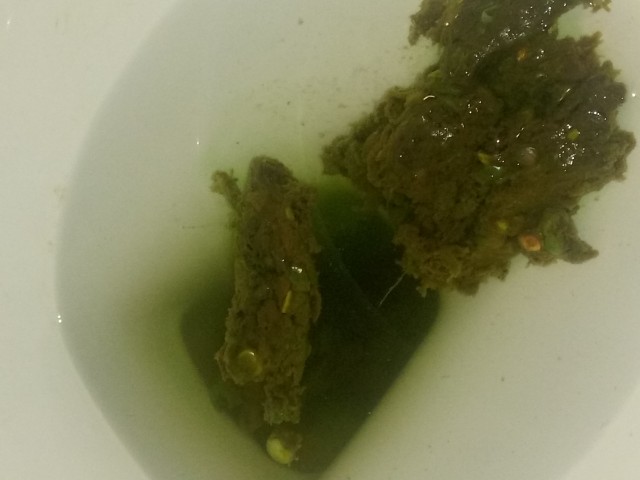 POOP picture tmi tmi - Glow Community