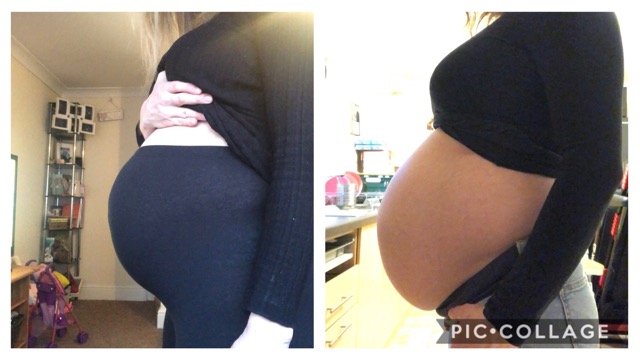 Does my bump look like it’s dropped? - Glow Community