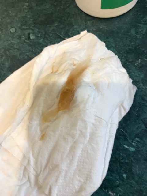 Mucus Plug 21 Weeks Pregnant Glow Community