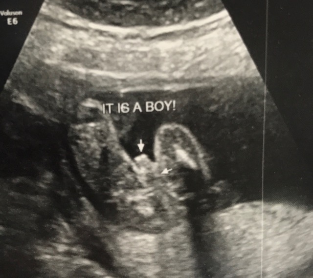 19 week anatomy scan 💙 - Glow Community