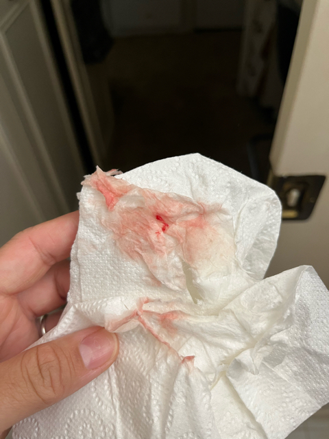 10dpo bleeding and faint lines - Glow Community