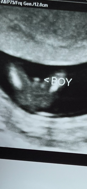 13 week ultrasound and gender was confirmed - sneak peek was correct ...