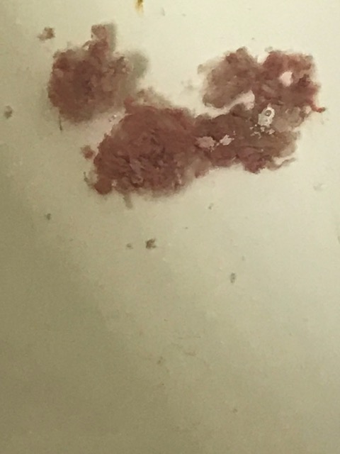 Bloody tissue TMI - Glow Community