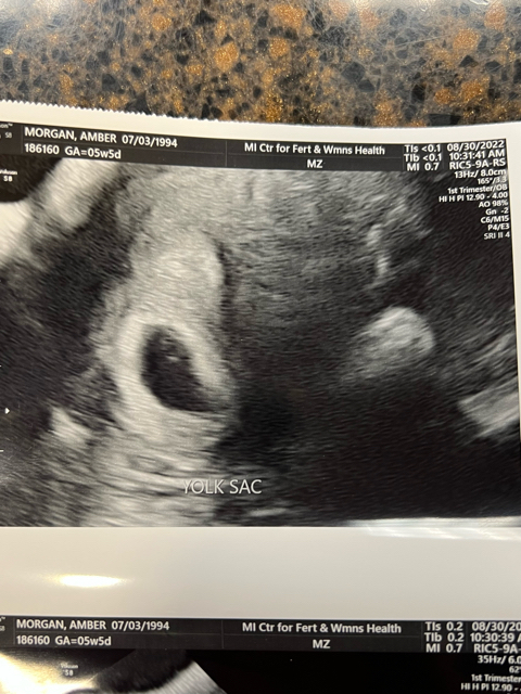 First ultrasound at 5w5d and measuring on time , we saw the yolk sac faintly! Look ok ? - Glow ...