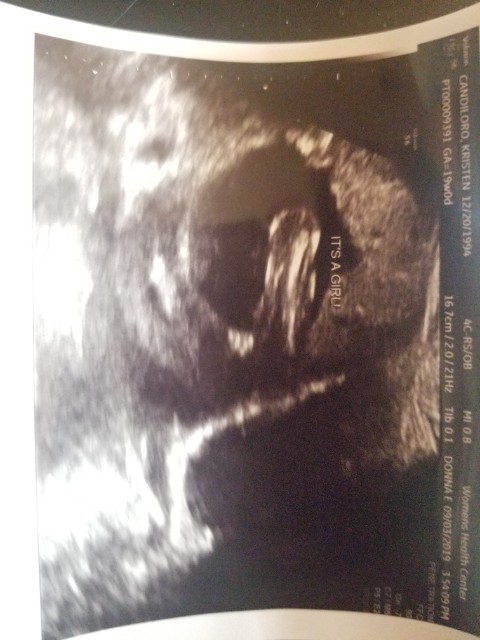 19 weeks Anatomy Scan! - Glow Community