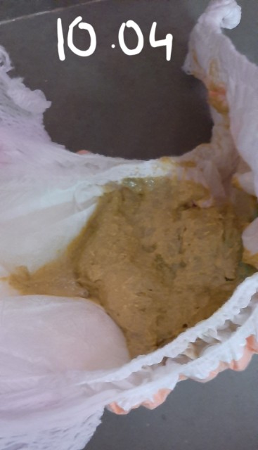 Urgent! Is this normal green for a formula fed? TMI pics of dirty ...