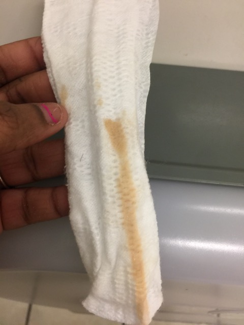 Is This Implantation Bleeding Ive Been Spotting For About 3days 9185