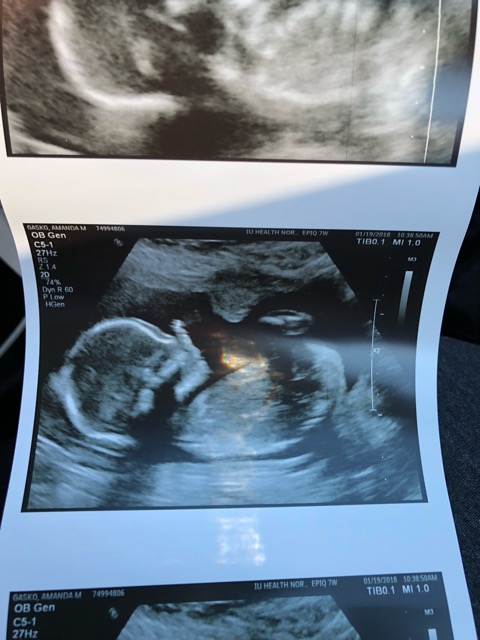 20 week/ anatomy scan!! - Glow Community