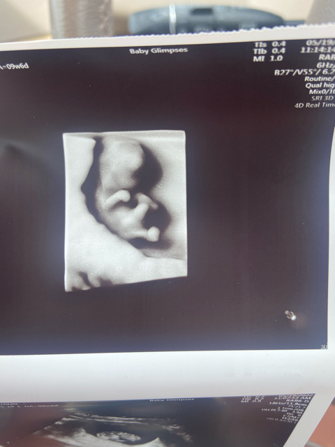 10 Weeks Exact Ultrasound Glow Community 10-weeks-exact-ultrasound-glow-community