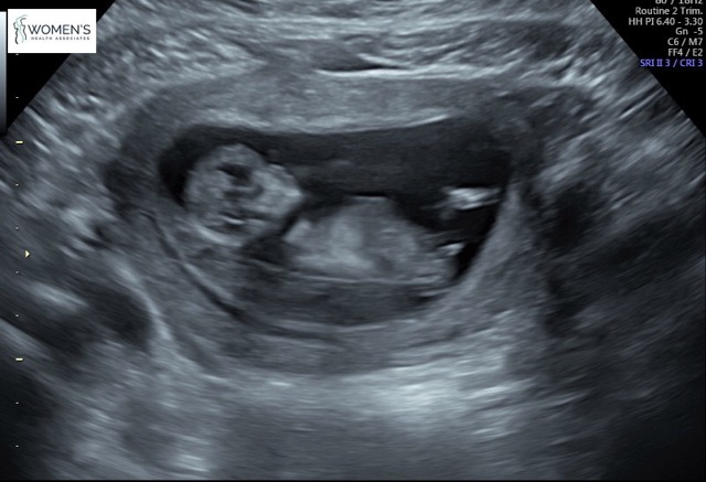 Nub theory 12 weeks - Glow Community