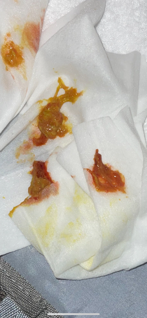 Red mucus in poopy diaper - Glow Community