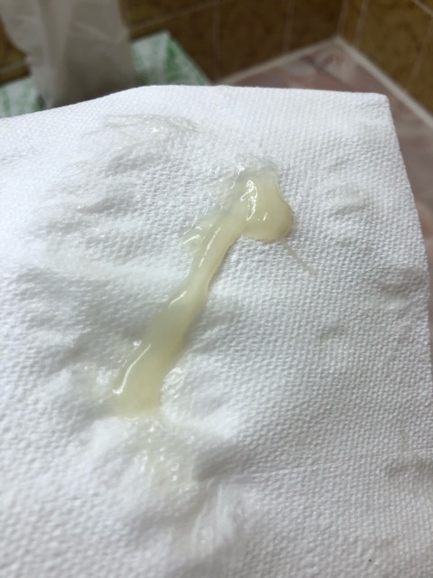 Mucus Plug At 31 Weeks Tmi Glow Community
