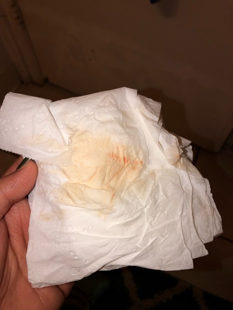 Implantation bleeding orange color. - Glow Community
