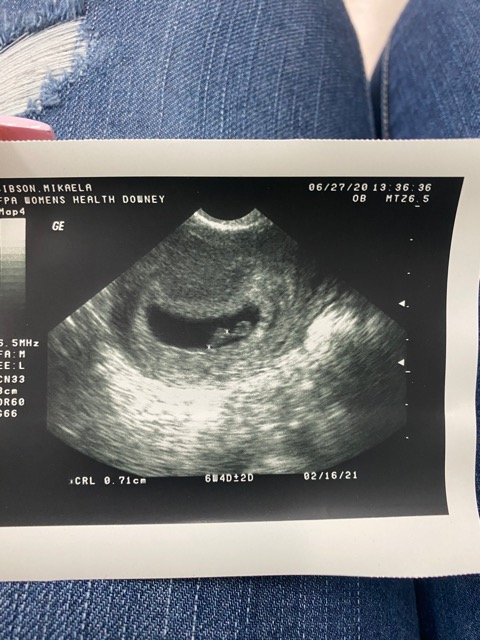 5 week ultrasound & 6 week 4 day ultrasound - Glow Community
