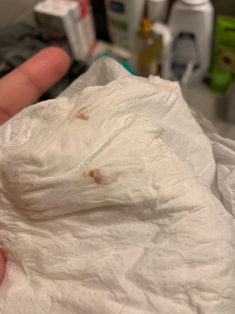 Is this start of af or implantation ( TMI PIC ) - Glow Community