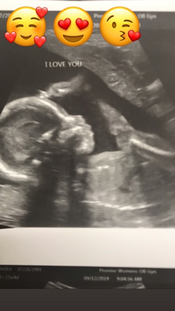 22 week anatomy ultrasound - Glow Community