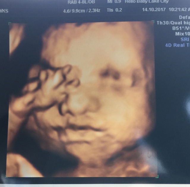 28 weeks 3D/4D ultrasound!!💕 - Glow Community