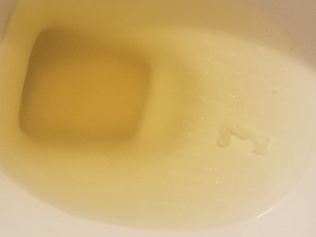 White Mucus In Urine