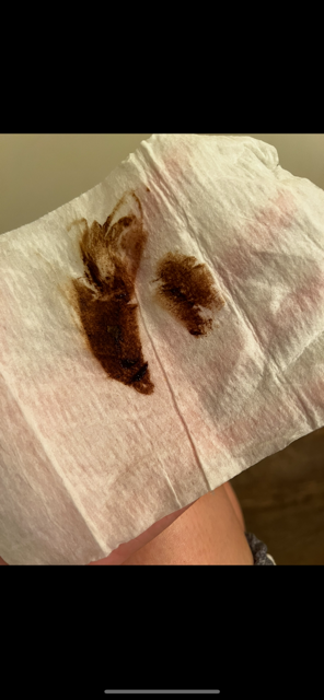 Is this normal color poop? TMI!!! Actual photos! - Glow Community