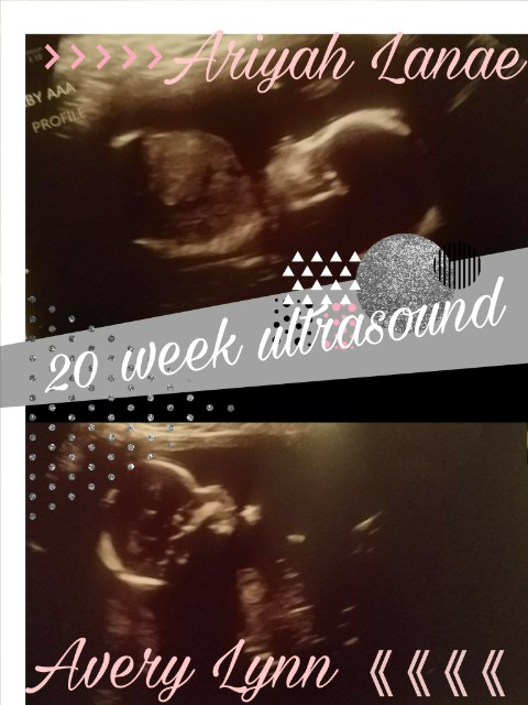 20 week scan! 😍 - Glow Community