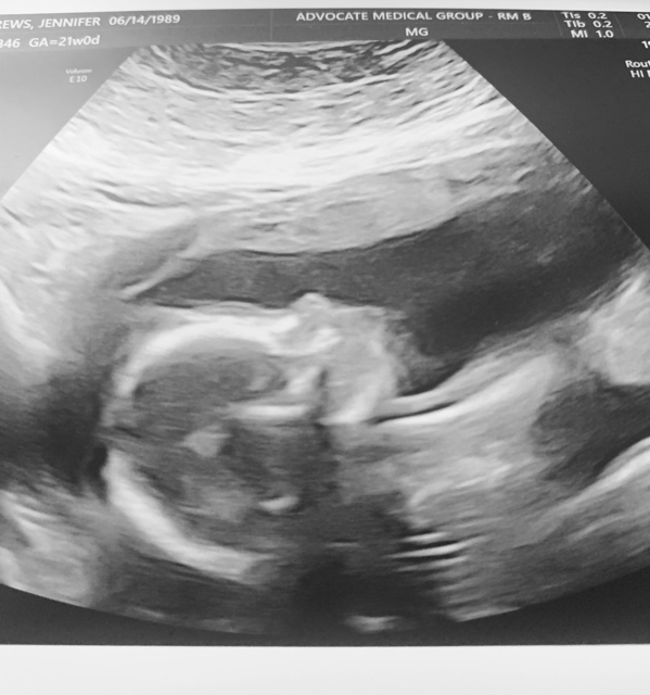 Anatomy Scan Glow Community anatomy-scan-glow-community