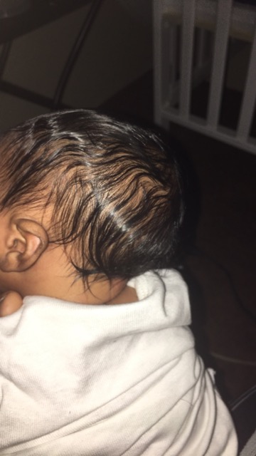 Placenta perm - Glow Community