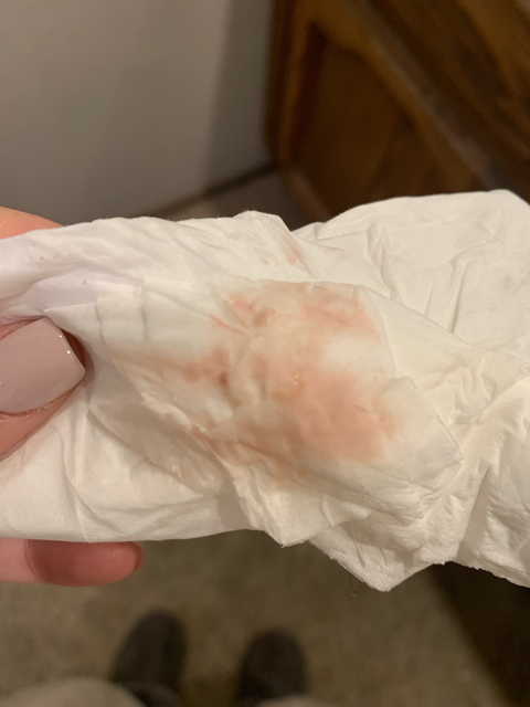 12 DPO - implantation bleeding? - Glow Community