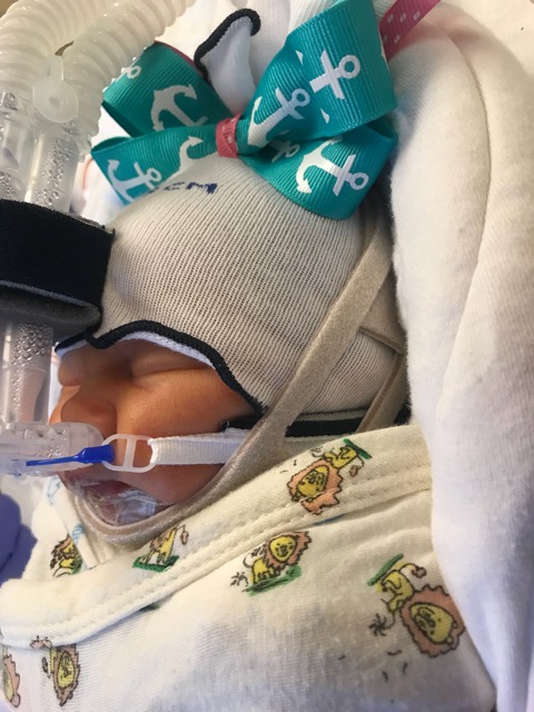 After 80 Days of Battling Rare and Deadly TRAP Pregnancy My Little ...