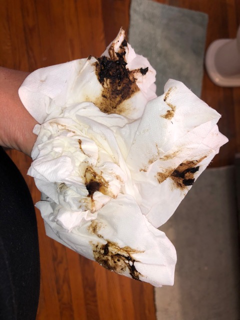 Mucus plug/Bloody Show - Glow Community