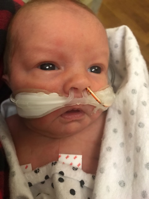 After 80 Days of Battling Rare and Deadly TRAP Pregnancy My Little ...