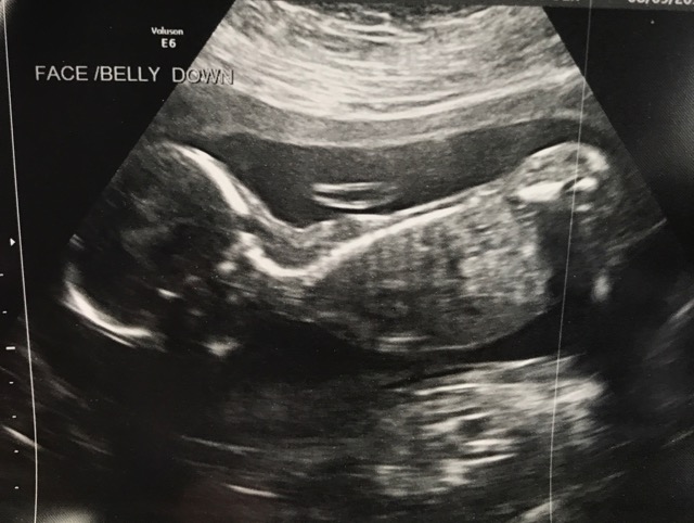 19 week anatomy scan 💙 - Glow Community