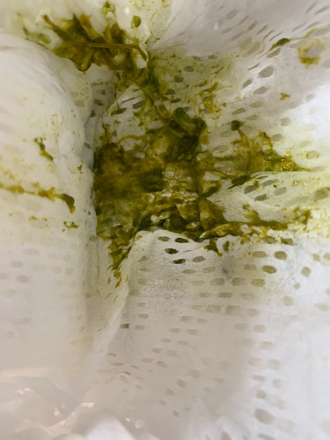 POOP pic *** are these normal EBF poops? 2 months old! - Glow Community