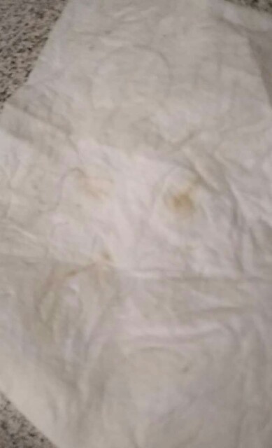 Implantation bleeding? 8dpo - Glow Community