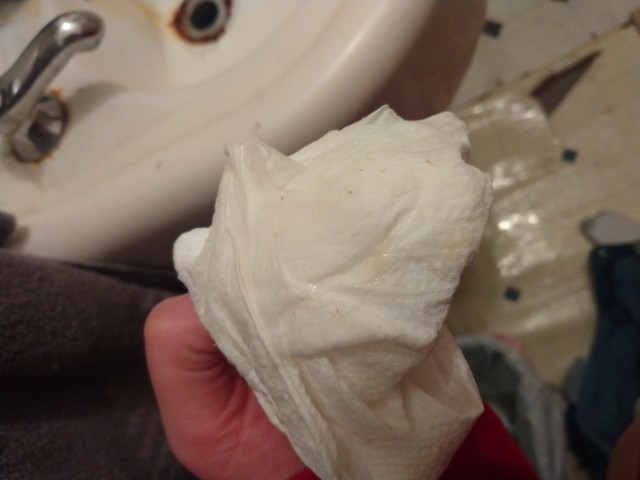 Is this normal discharge? - Glow Community