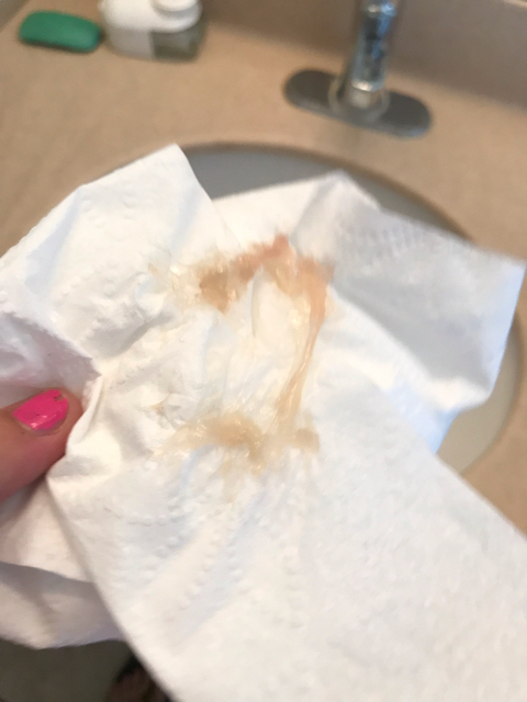 TMI picture!!!! Mucous plug?? - Glow Community